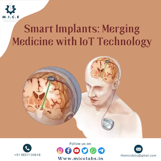 Smart Implants: Merging Medicine with IoT Technology